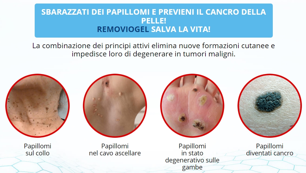 ᐉ Removio in Farmacia - [Sconto del 50%] Prezzo - Recensioni mediche ...
